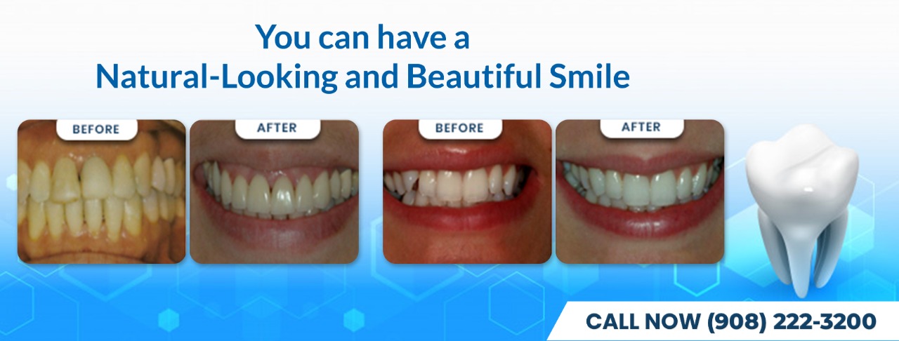 Dentist in edison – Daleel